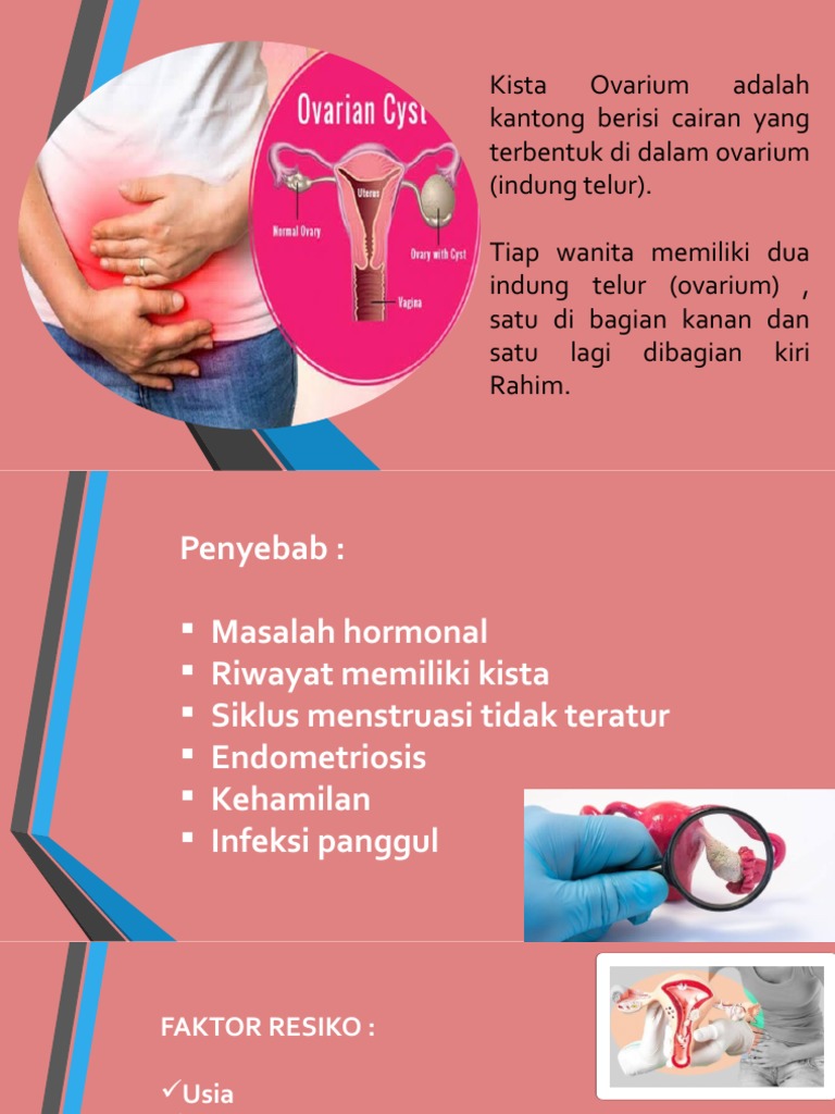 Lembar Balik Kista Ovarium | PDF