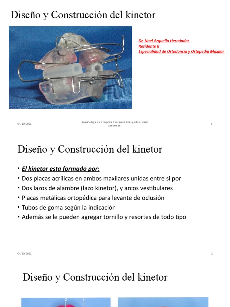 Diseño del Kinetor en Ortopedia Funcional | PDF