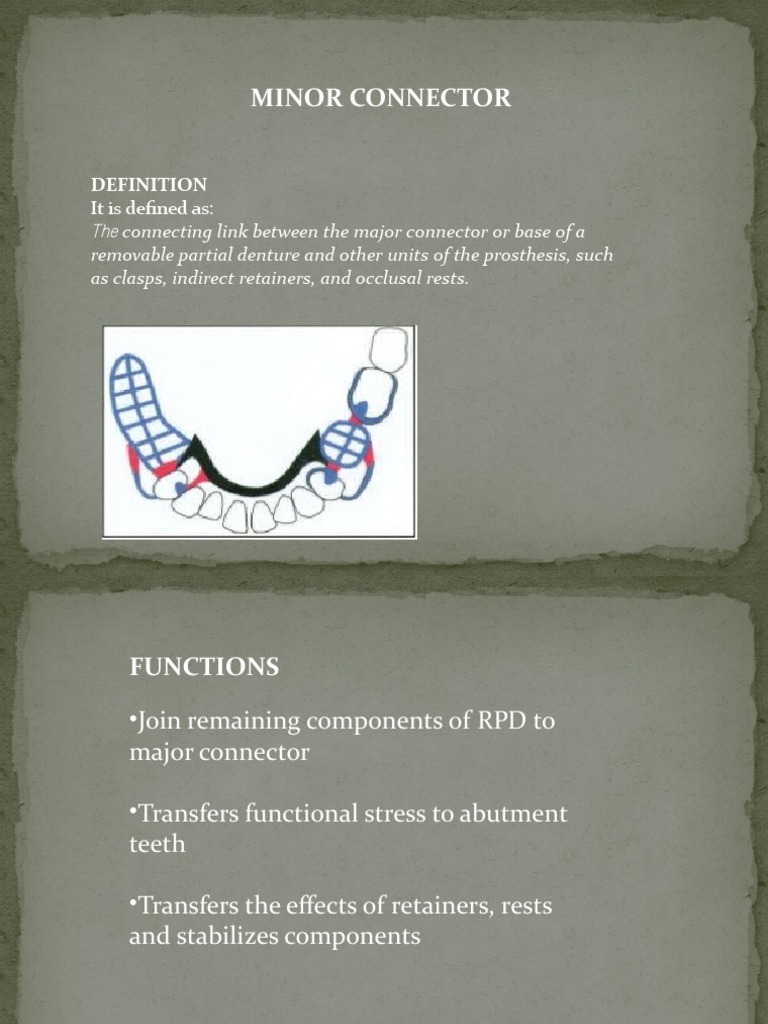 Minor Connectors and Direct Retainer Complete | PDF | Mouth | Dentistry