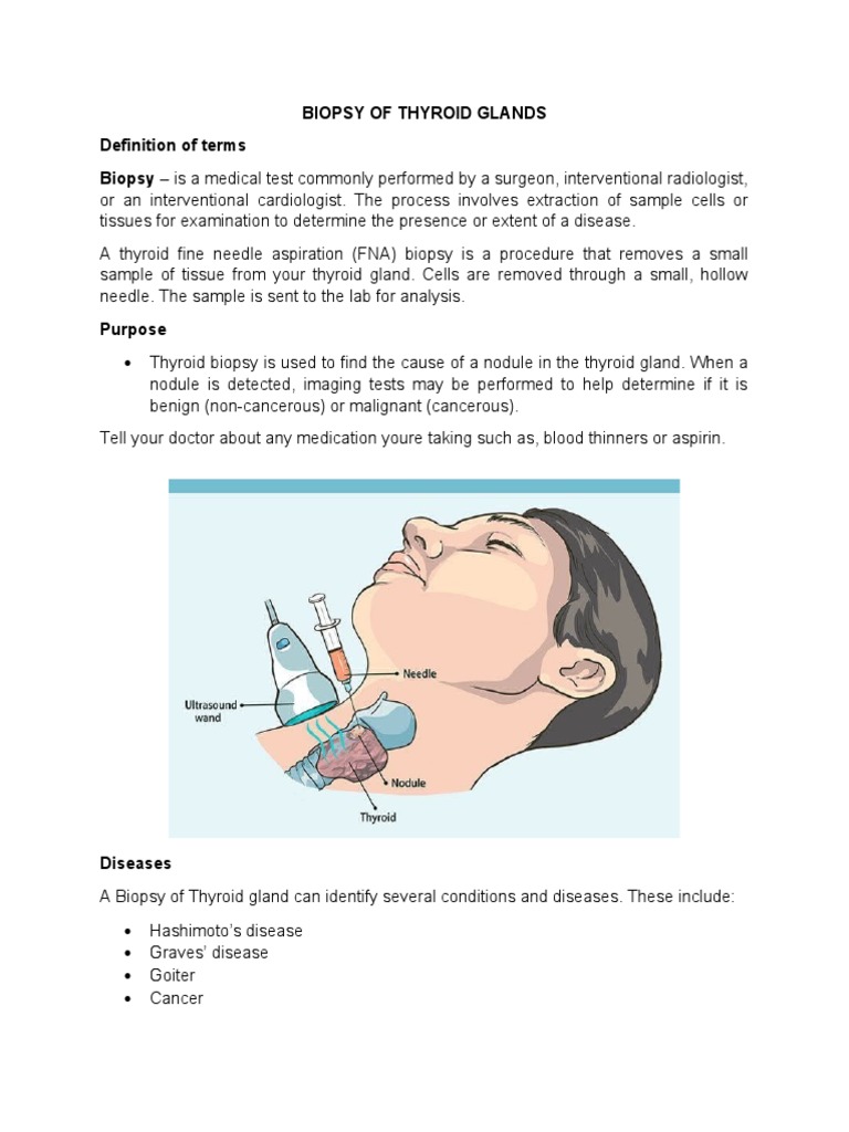 An Overview of Thyroid Biopsy: Indications, Procedures, Nursing Care ...