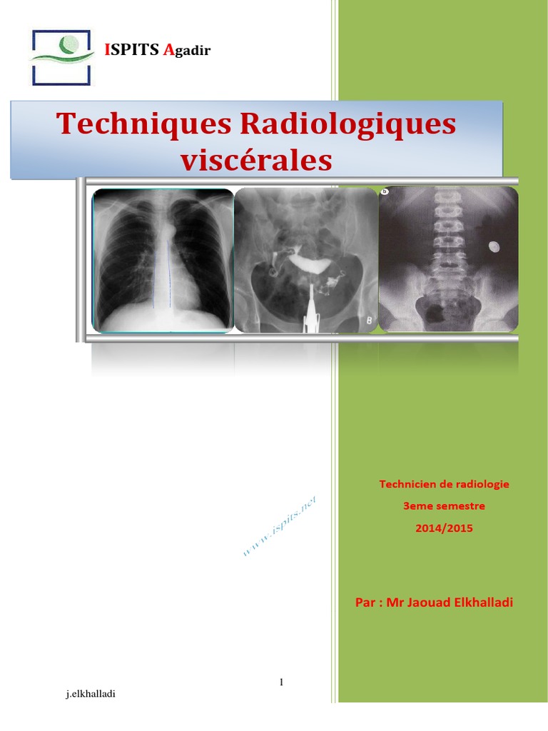 Vessie en semi-réplétion en radiologie | PDF | Utérus | Poumon