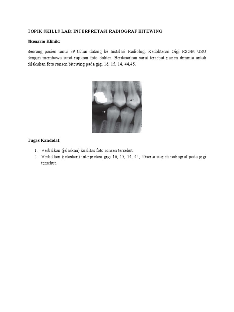 Interpretasi Radiografi Bitewing Gigi | PDF | Kajian Bahasa Asing
