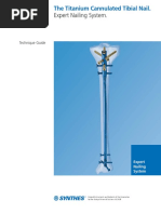 T2 Tibial Nailing System - Stryker | PDF | Anatomical Terms Of Motion ...