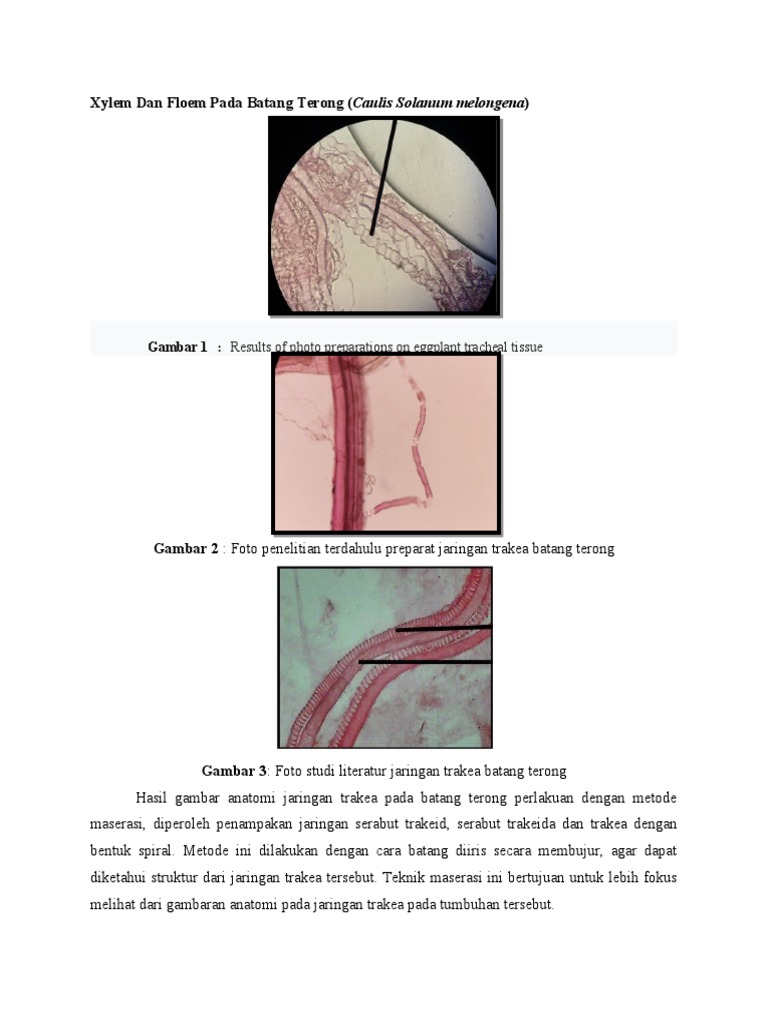 Xylem Dan Floem Pada Batang Terong | PDF