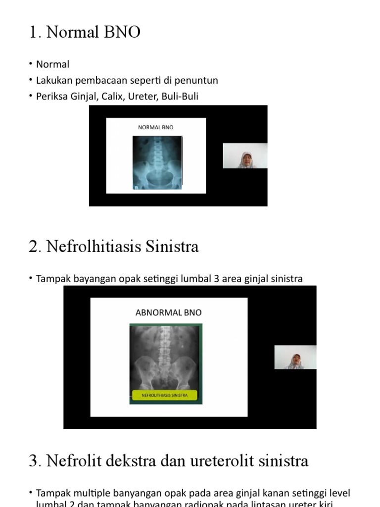 Normal BNO: - Normal - Lakukan Pembacaan Seperti Di Penuntun - Periksa ...