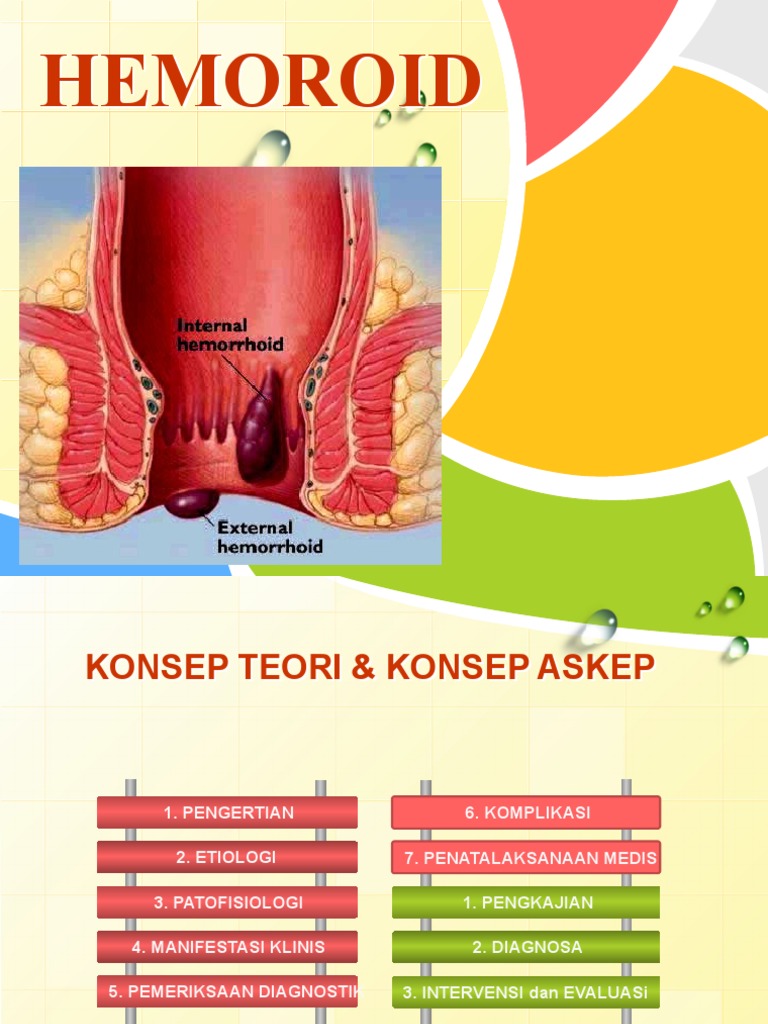 Penatalaksanaan Hemoroid Eksterna Grade 4 | PDF
