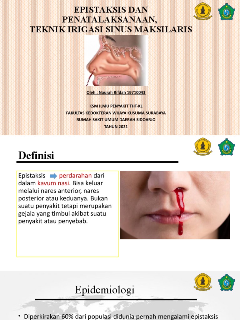 Epistaksis Dan Penatalaksanaan | PDF