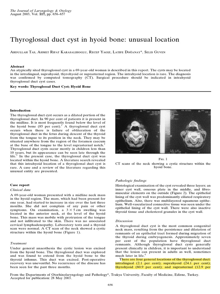 Thyroglossal Duct Cyst in Hyoid Bone: Unusual Location: The Journal of ...