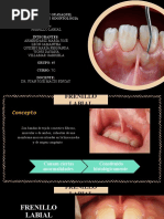 Clasificacion de Frenillos | PDF | Lengua | Boca