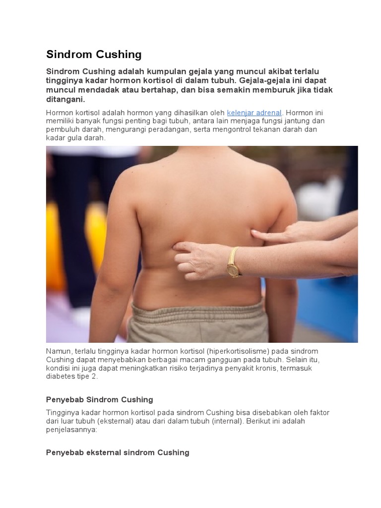 Sindrom Cushing | PDF