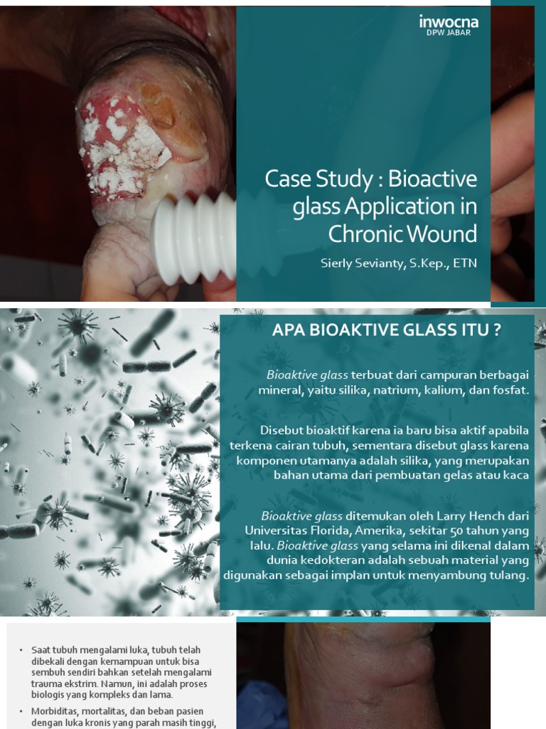 Case Study Bioglass | PDF