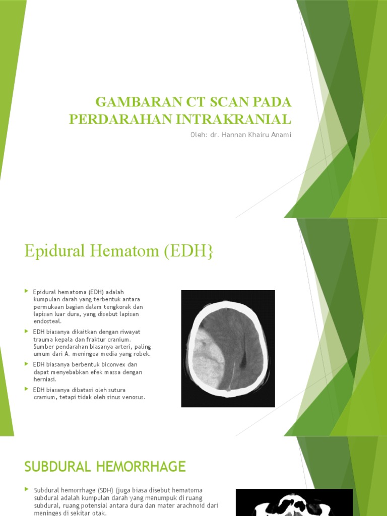 Gambaran CT Scan Pada Perdarahan Intrakranial | PDF