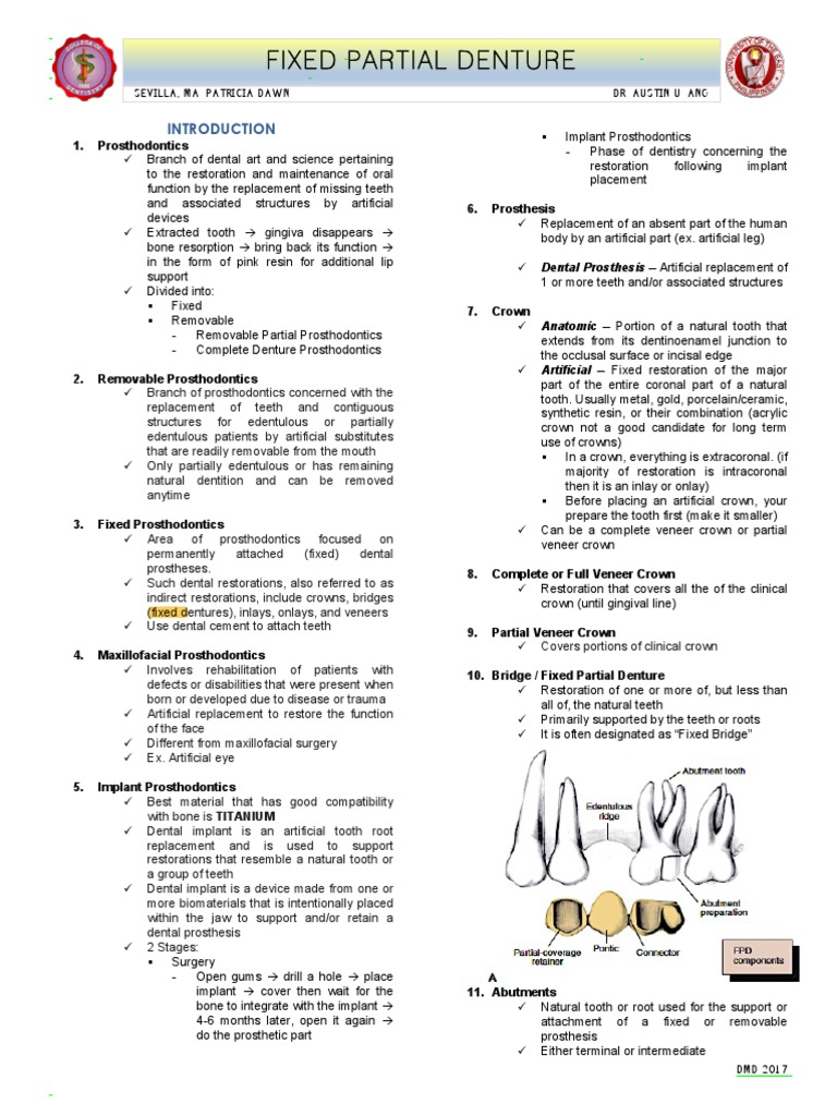 Fixed Partial Denture Guide | PDF | Dental Implant | Dentures