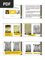 Panoramic Radiograph Interpretation Guide | PDF | Primate Anatomy ...