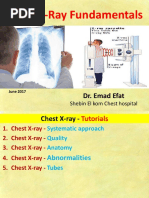 Chest X-Rays - Questions | PDF