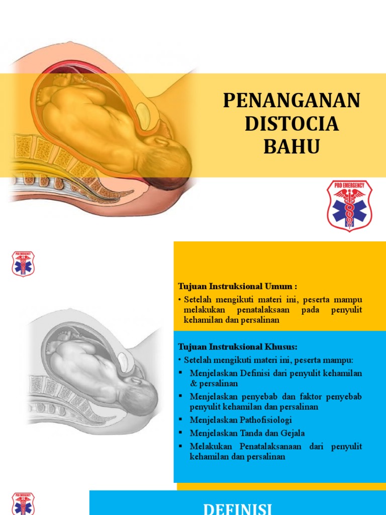 Distosia Bahu | PDF | Kesehatan Holistik