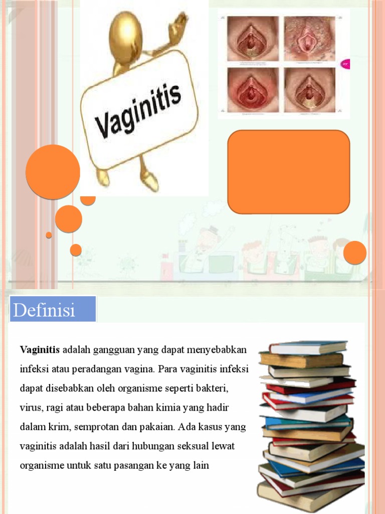 VAGINITIS | PDF