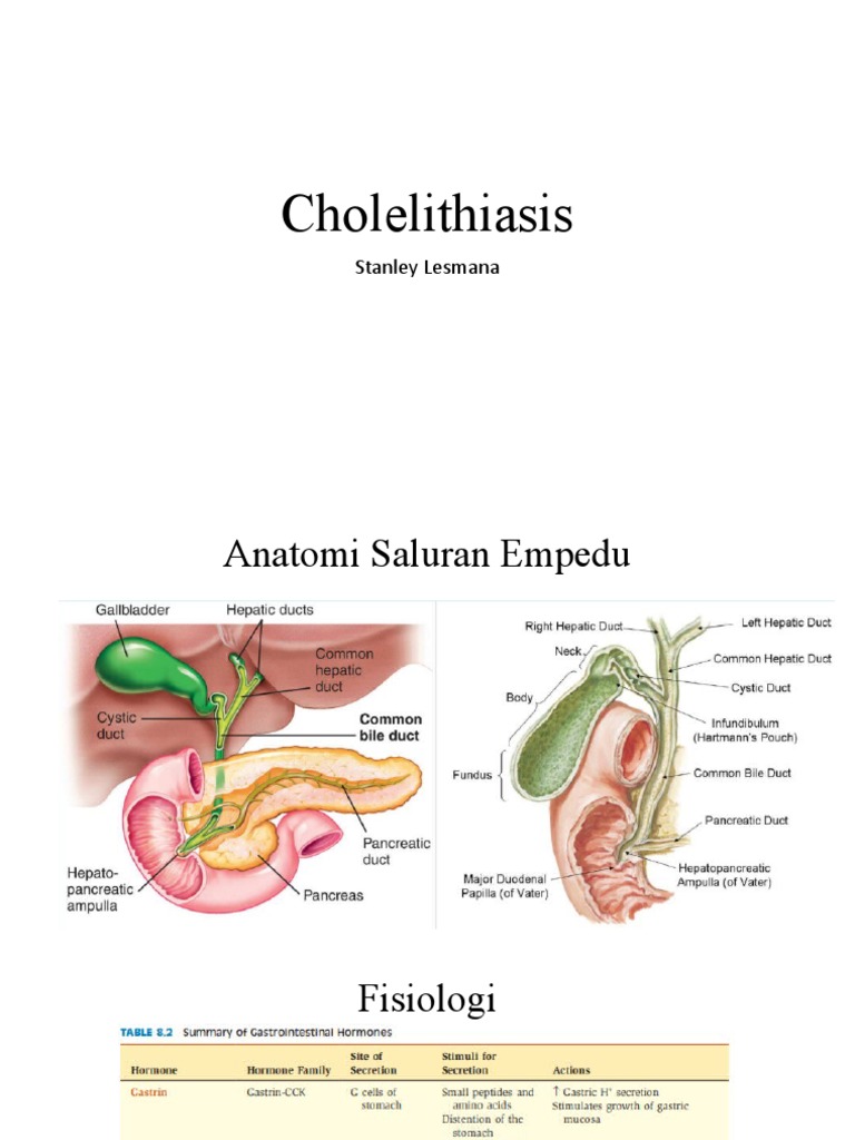 Cholelithiasis | PDF