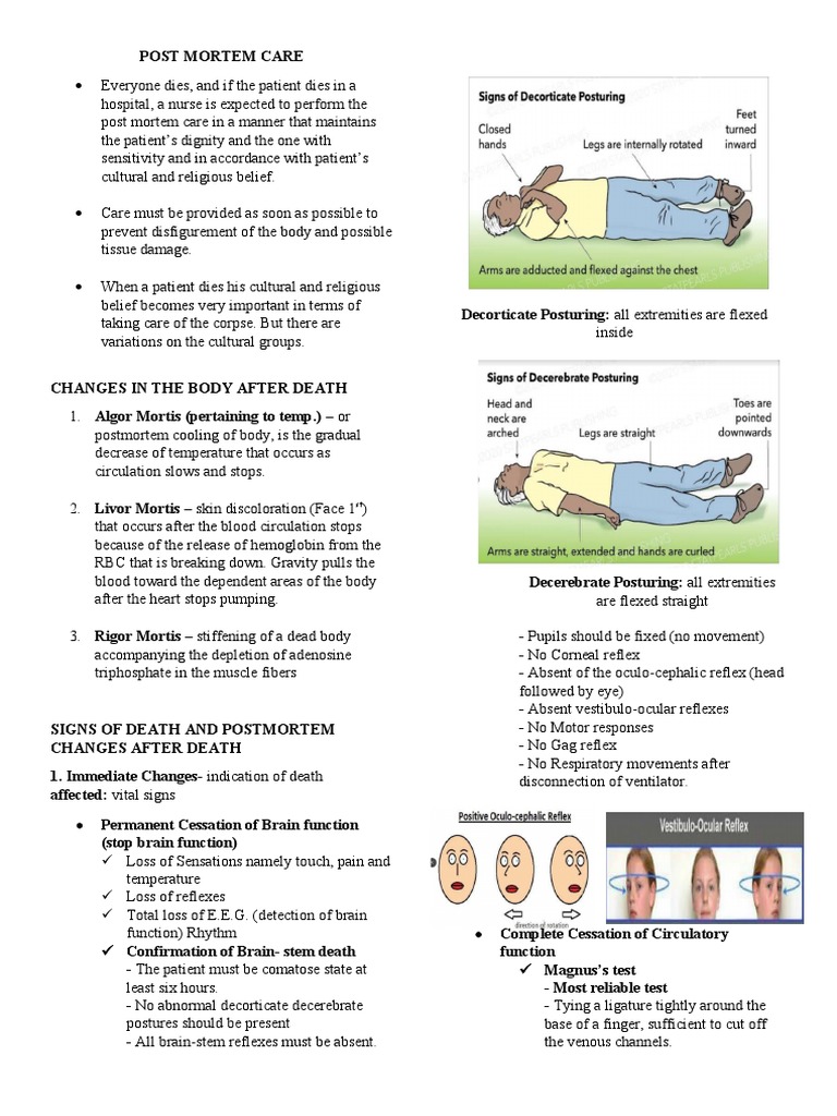 Post Mortem Body Movement