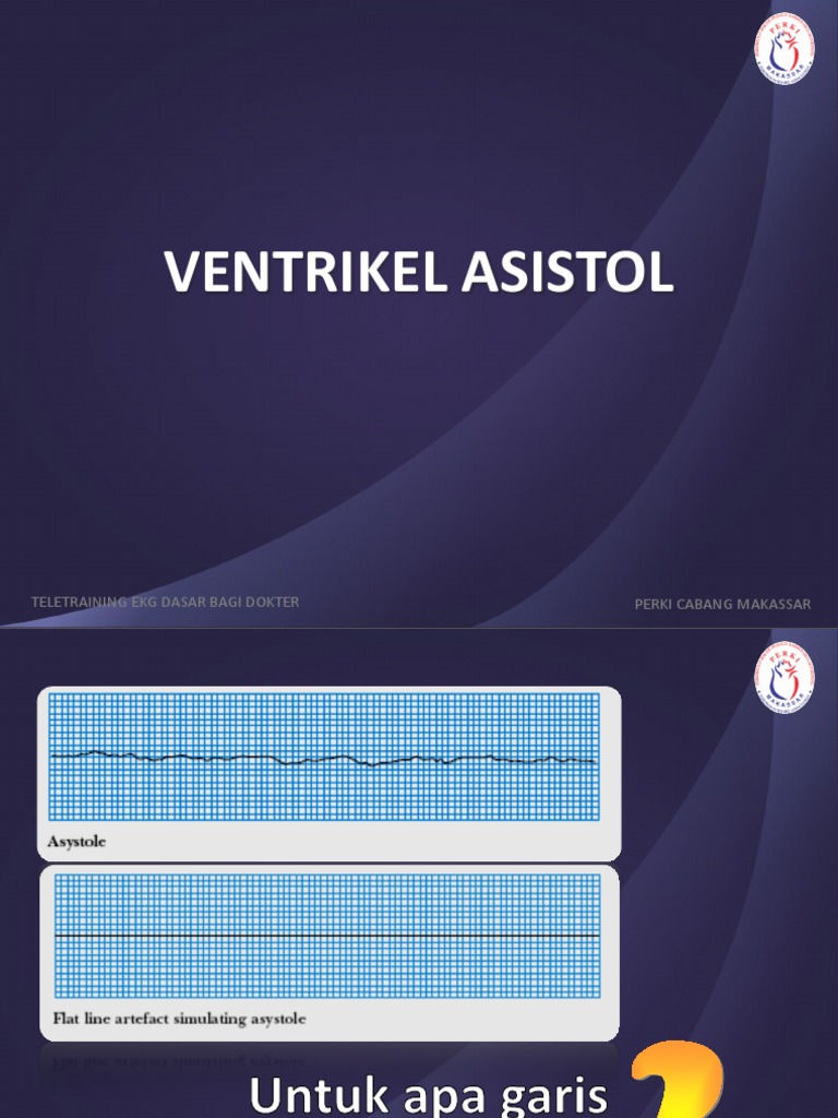 Ventrikel Asistol | PDF