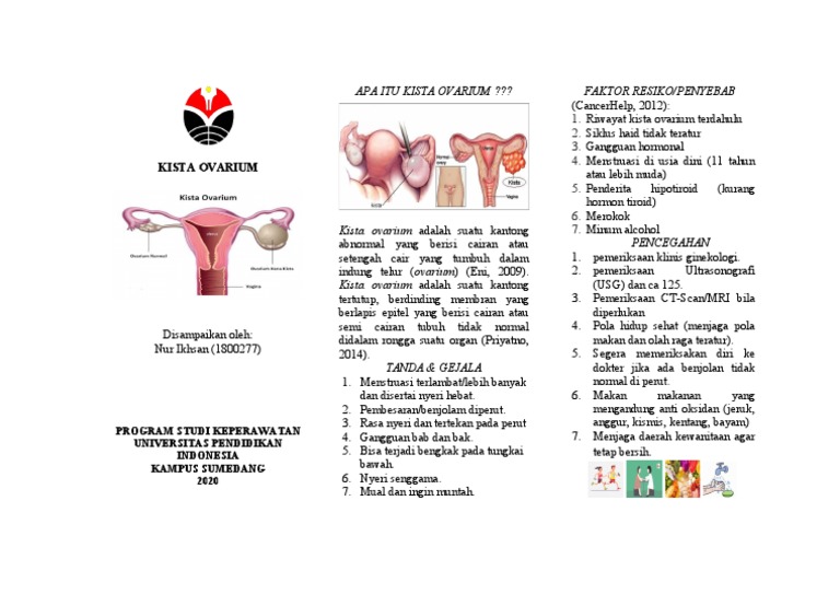 Leaflet Kista Ovarium | PDF | Sains & Matematika