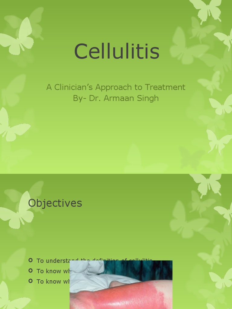 Cellulitis: A Clinician's Approach To Treatment By-Dr. Armaan Singh ...