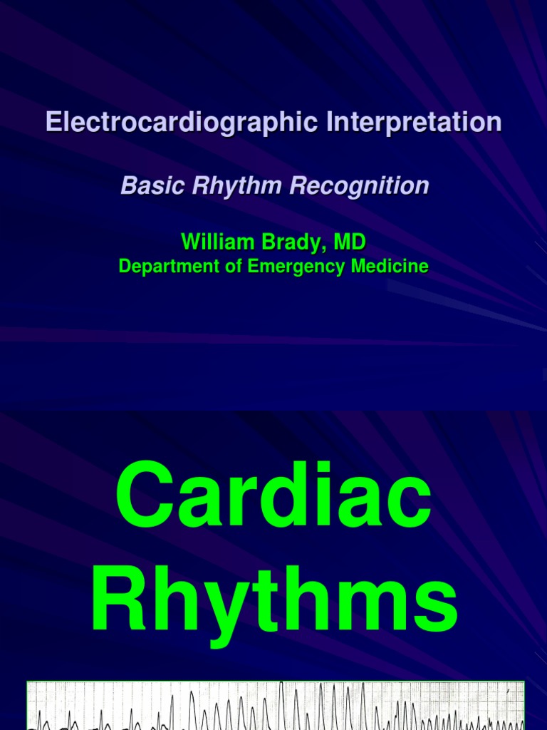 ECG Rhythm Interpretation Guide | PDF | Artificial Cardiac Pacemaker ...
