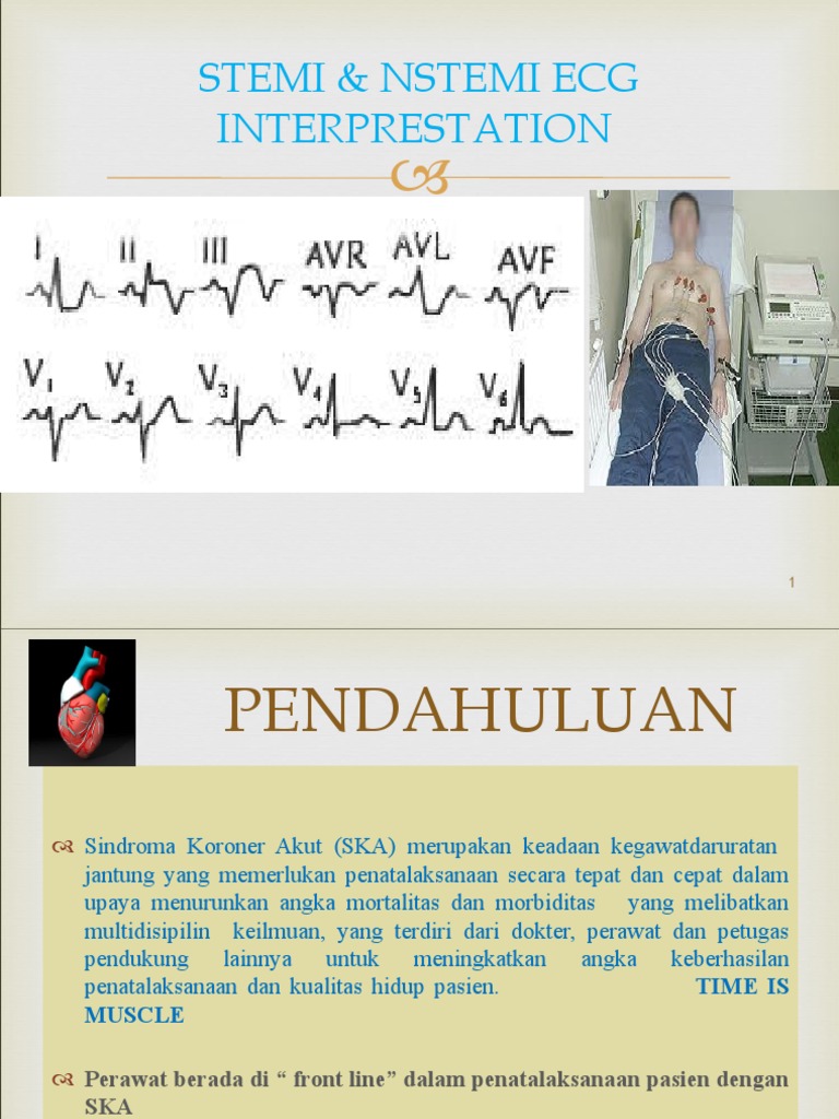 Ekg Stemi & Nstemi Bogor 2019 | PDF