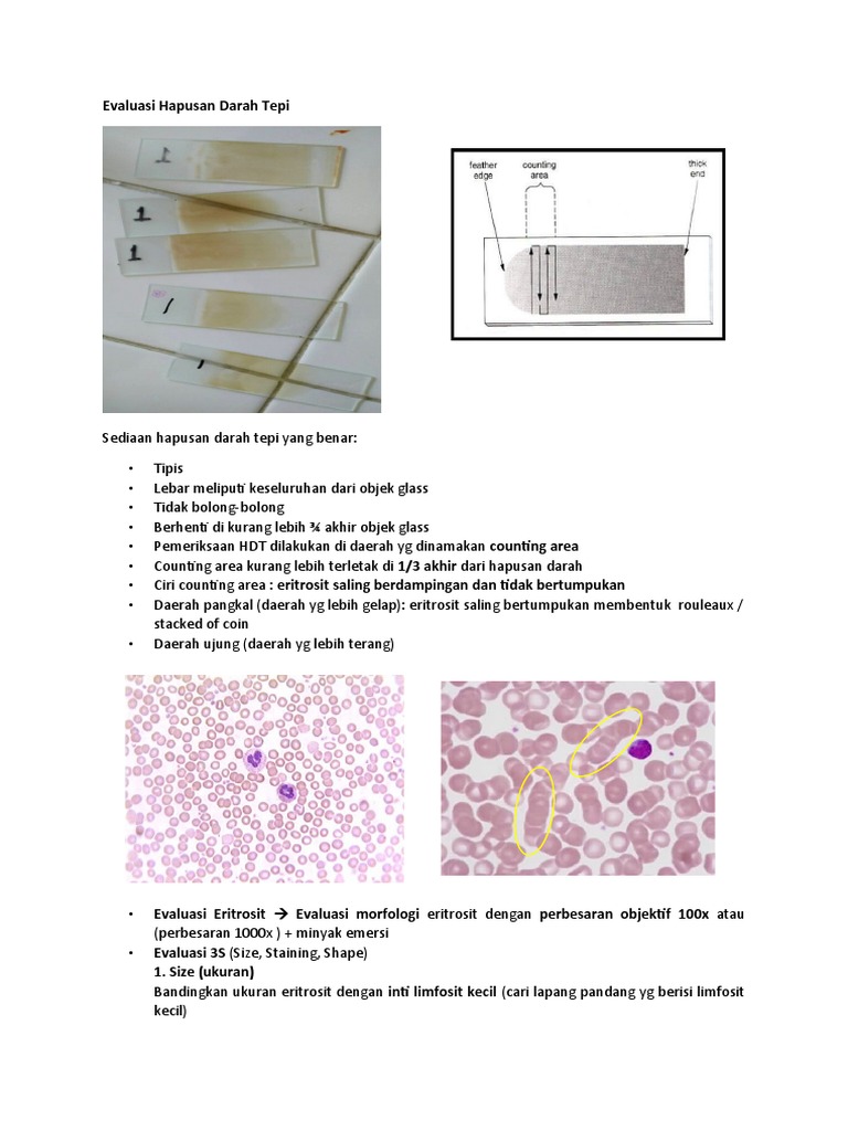 Evaluasi HDT Eritrosit (Pada Derajat Anemia) | PDF