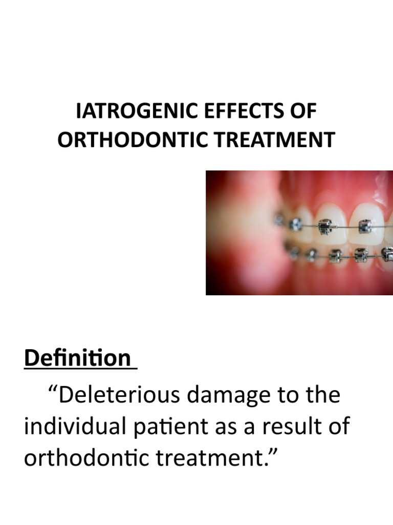 Iatrogenic Effects of Orthodontic Treatment | PDF | Tooth Enamel ...