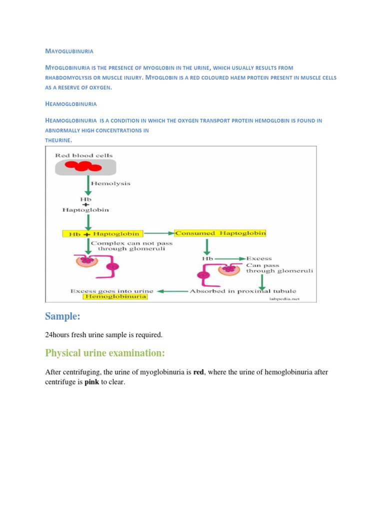 Hemoglobinuria Vs Myoglobinuria