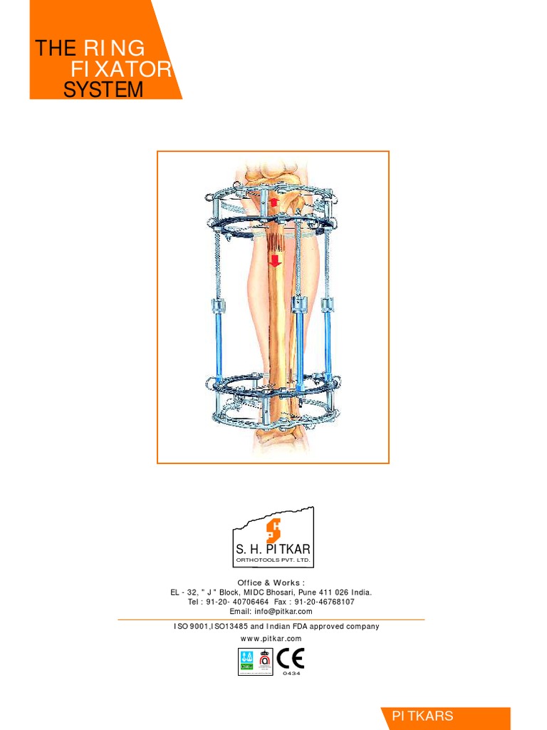 4.1 Fixator Extern Circular Ilizarov | PDF | Screw | Bone