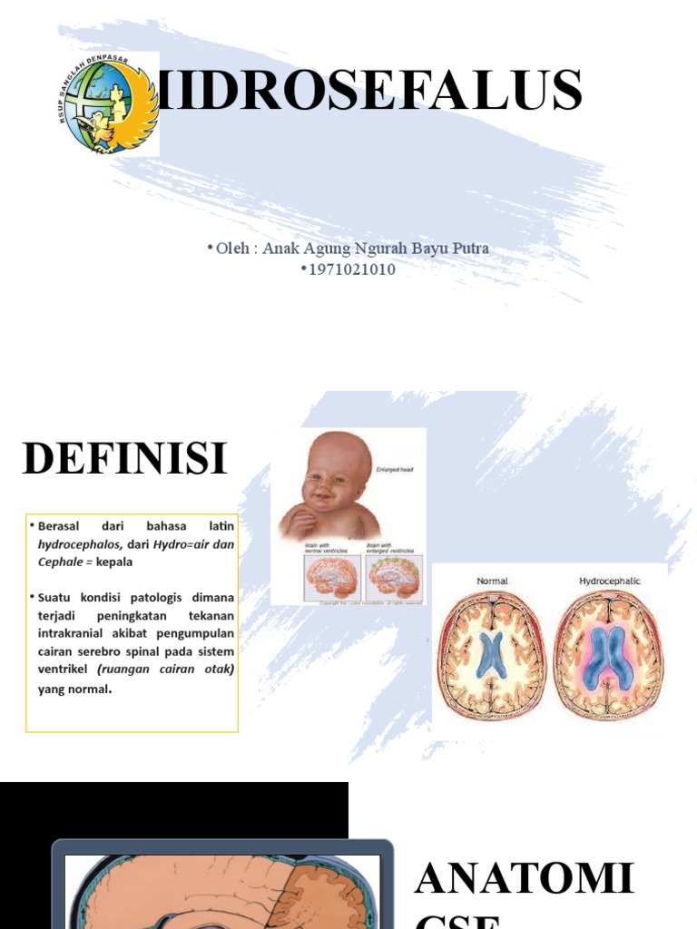 Ilmiah Hidrosefalus | PDF