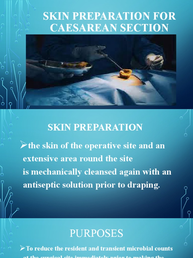Skin Preparation For Caesarean Section | PDF | Surgery | Clinical Medicine