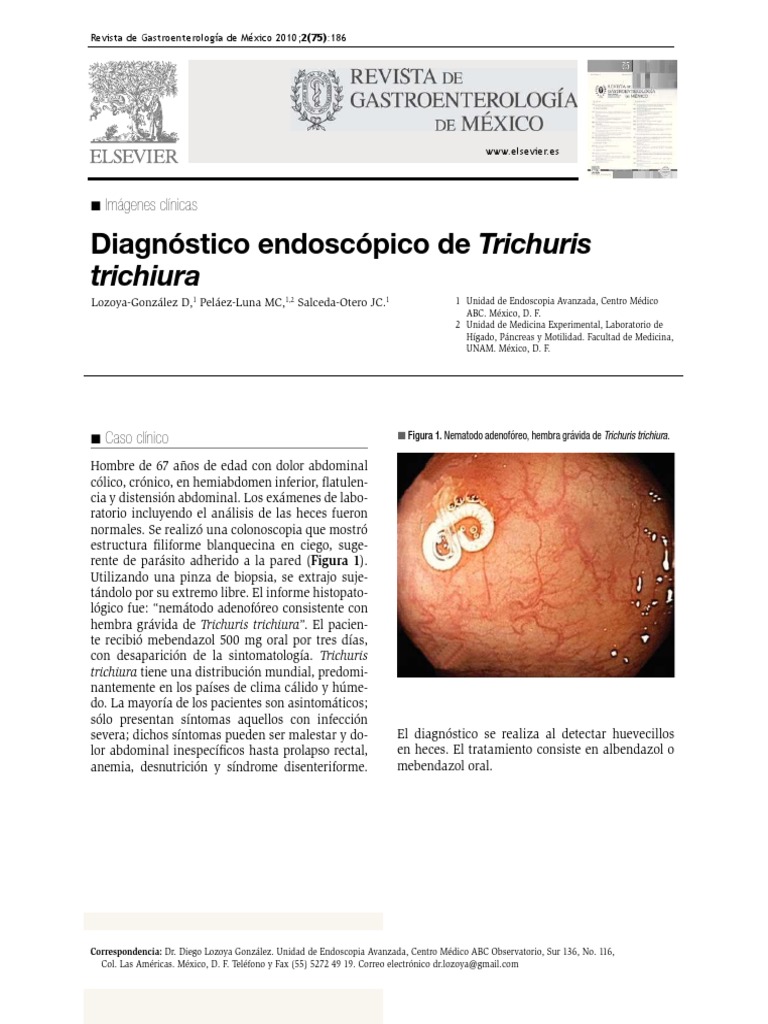 Trichuris Trichiura | PDF