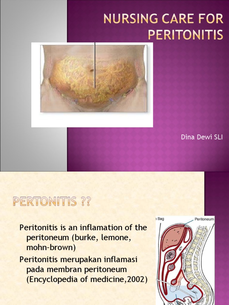 Askep Peritonitis | PDF | Peritoneum | Gastroenterology