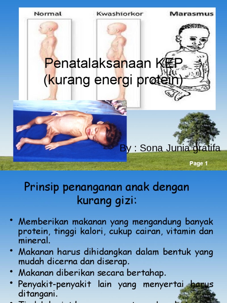 Penatalaksanaan KEP (Kurang Energi Protein) | PDF
