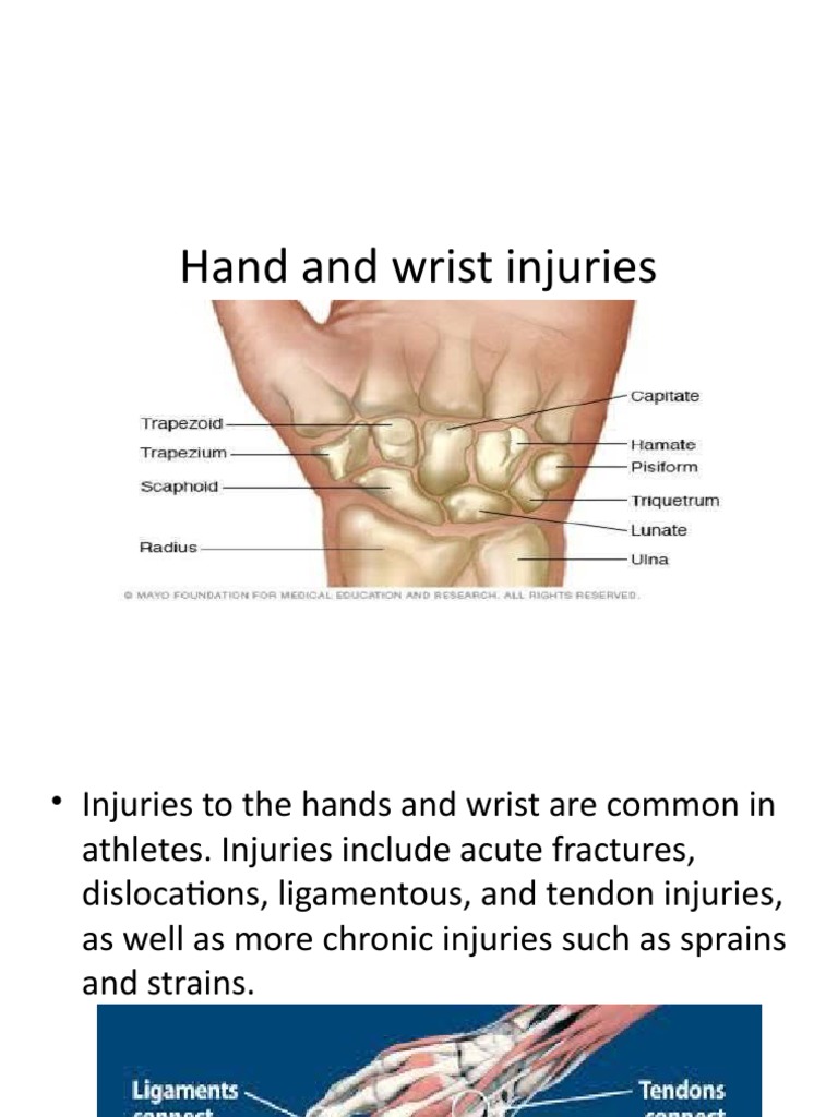 Hand and Wrist Injuries | PDF | Hand | Skeletal System