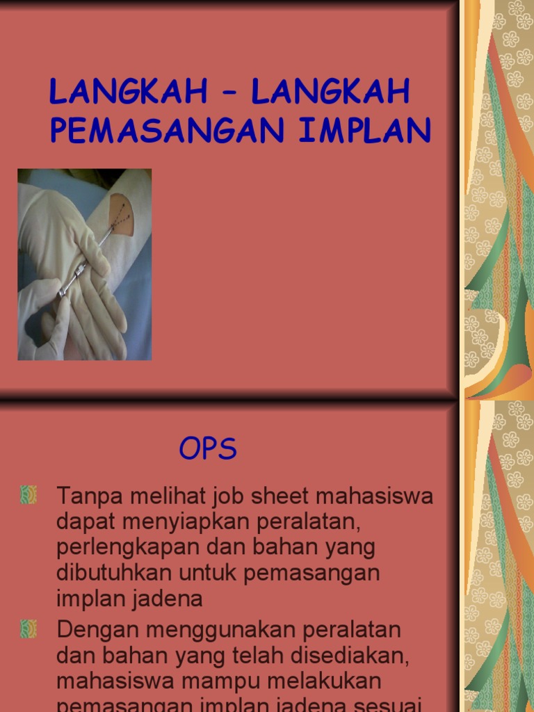 Langkah - Langkah Pemasangan Implan | PDF