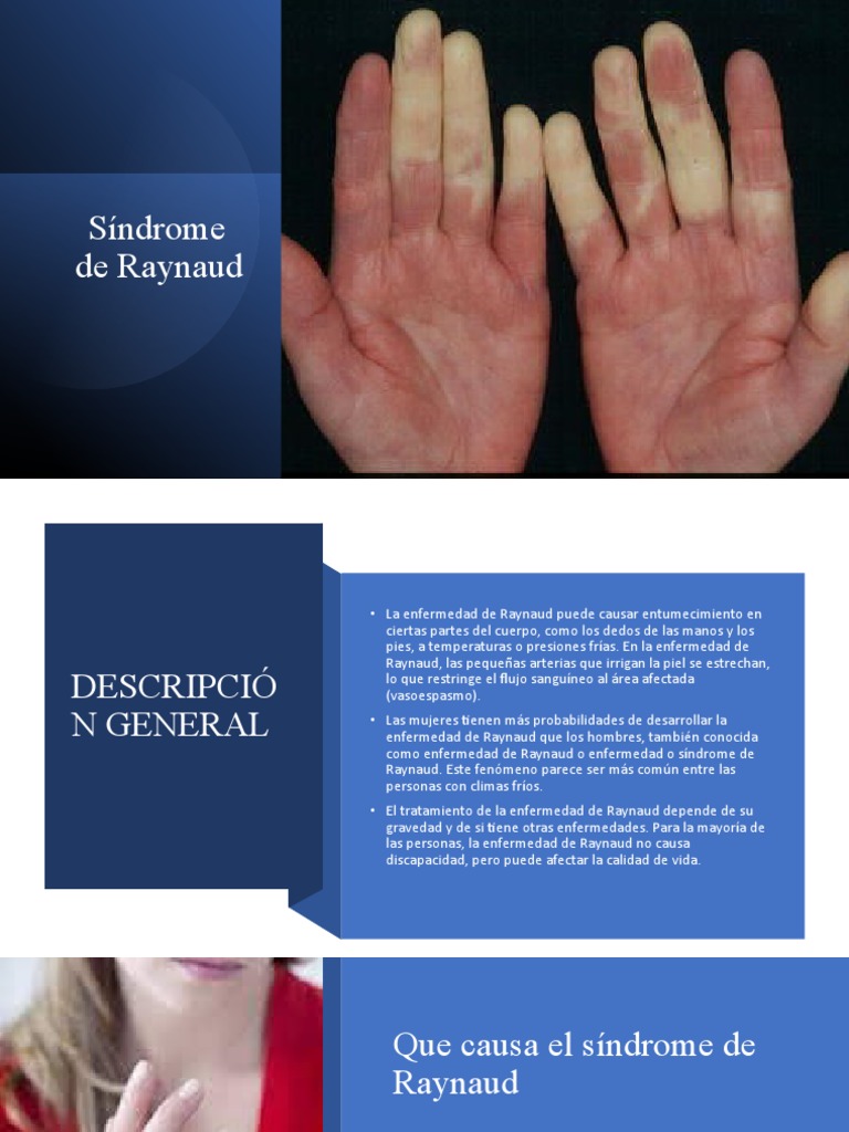 Diapositivas Enfermedad Raynaud | PDF | Enfermedades y trastornos ...