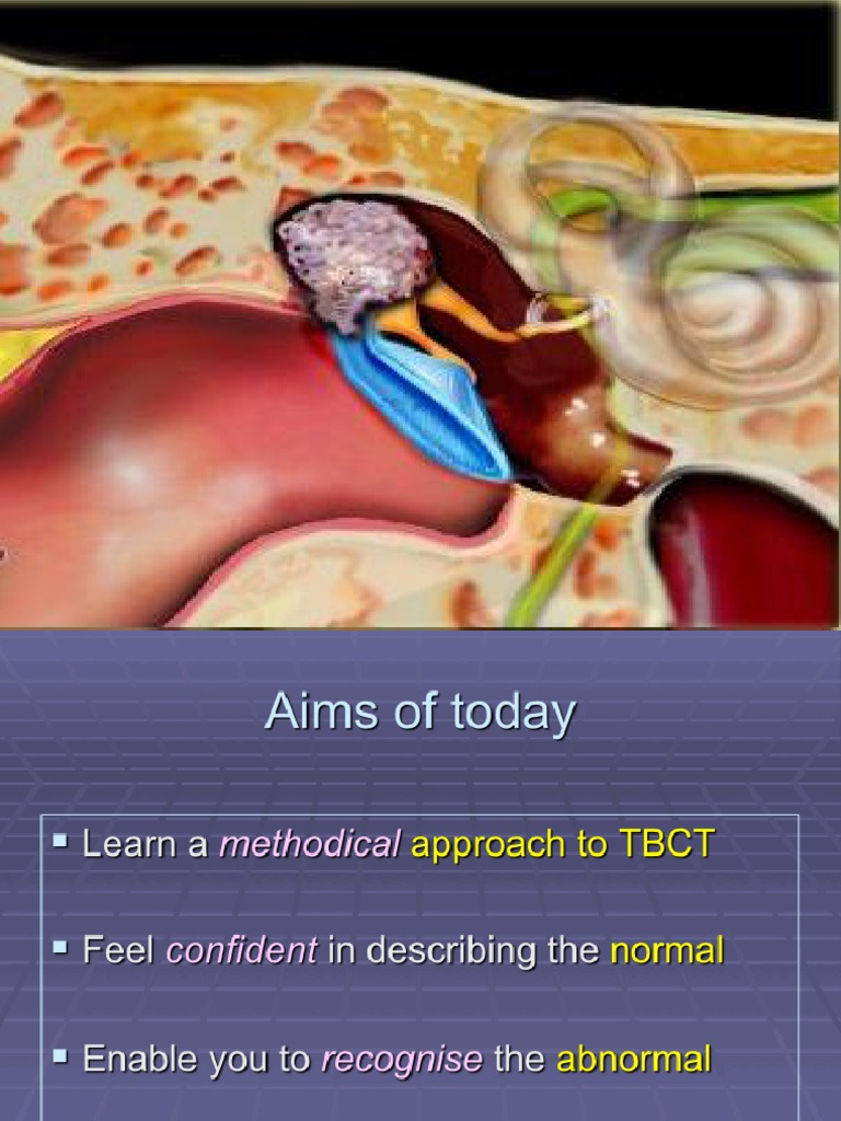 Temporal Bone Radiology Ready | PDF | Ear | Otorhinolaryngology