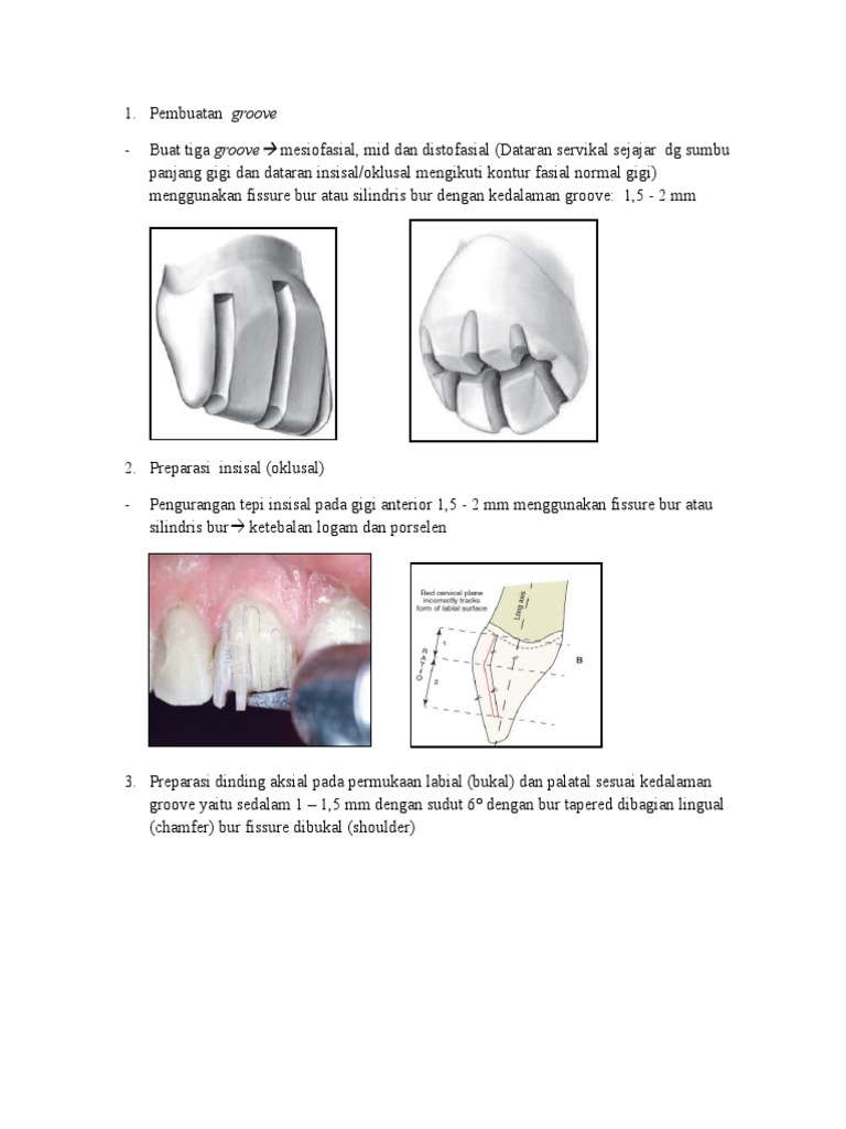 Preparasi Gigi Anterior dan Groove | PDF