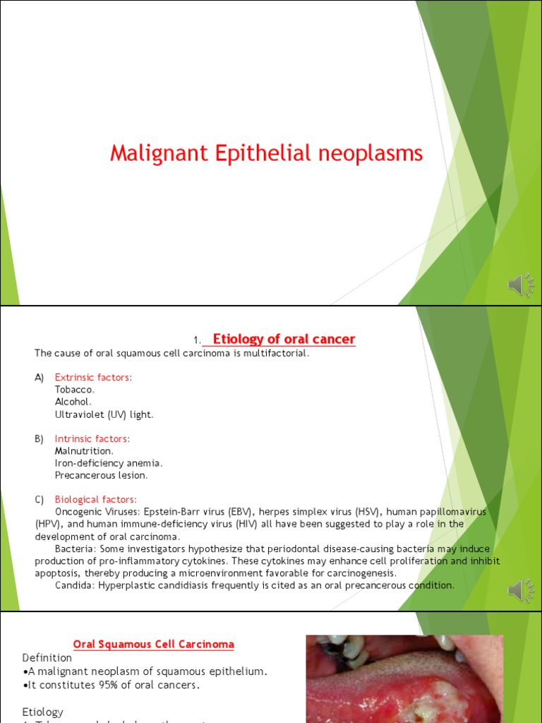 Malignant Epithelial Neoplasms | PDF | Carcinoma | Epithelium