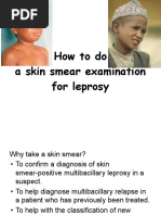 Slit Skin Smear Test Guide | PDF | Leprosy | Cytopathology