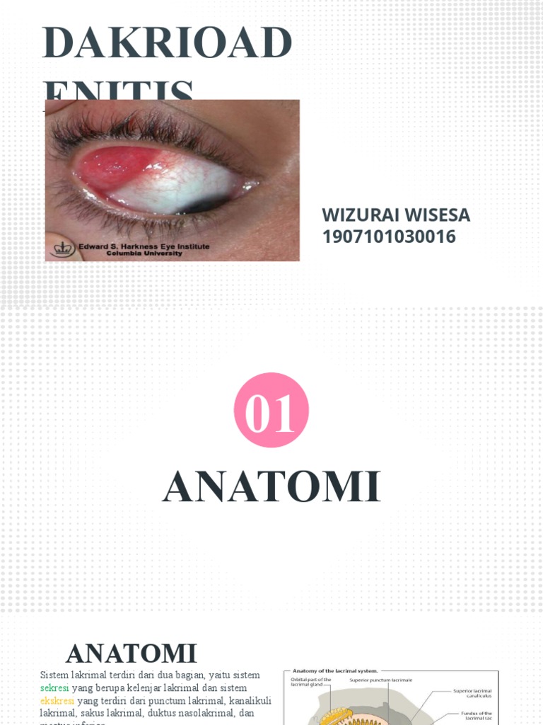 Kak Zura Dakrioadenitis | PDF