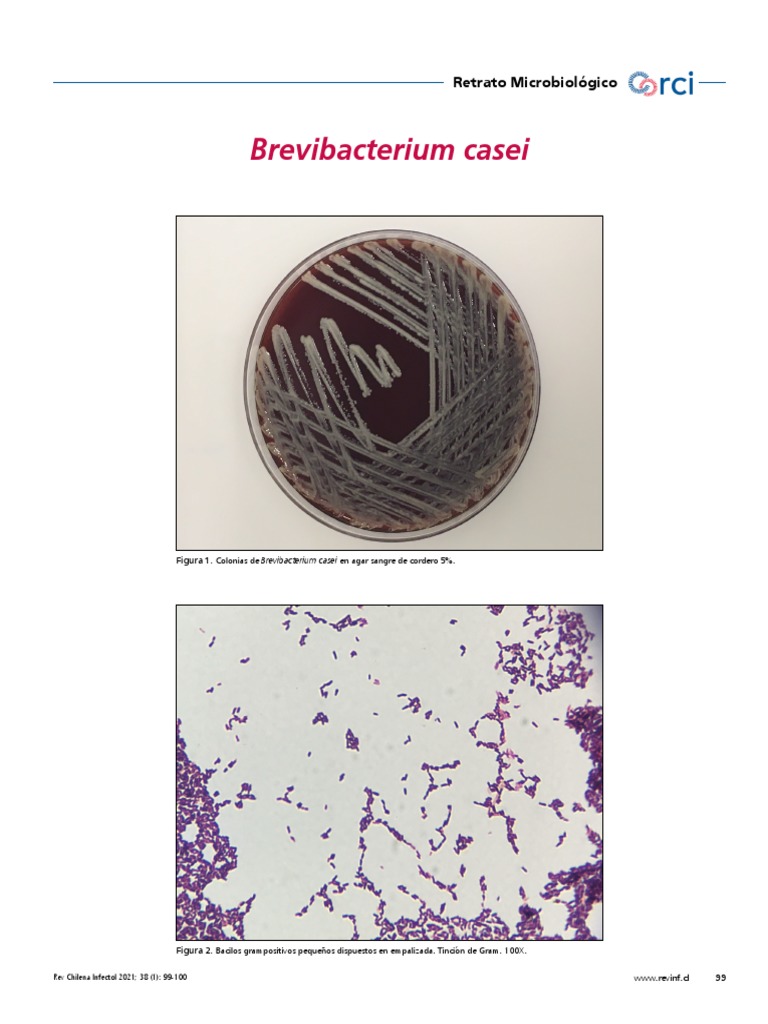 Retrato Microbiológico Brevibacterium Casei | PDF | Las bacterias ...