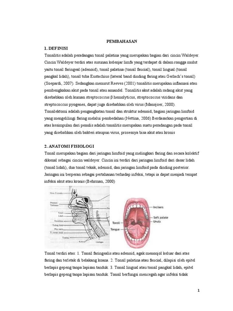 Laporan Pendahuluan Tonsilitis | PDF