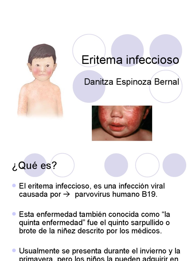 Eritema Infeccioso | PDF