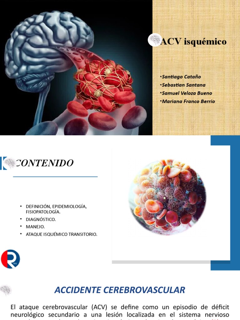 ACV Isquémico | PDF | Neurología | Carrera