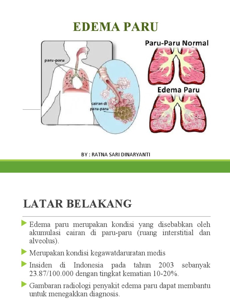 Edema Paru: Diagnosis & Penanganan | PDF